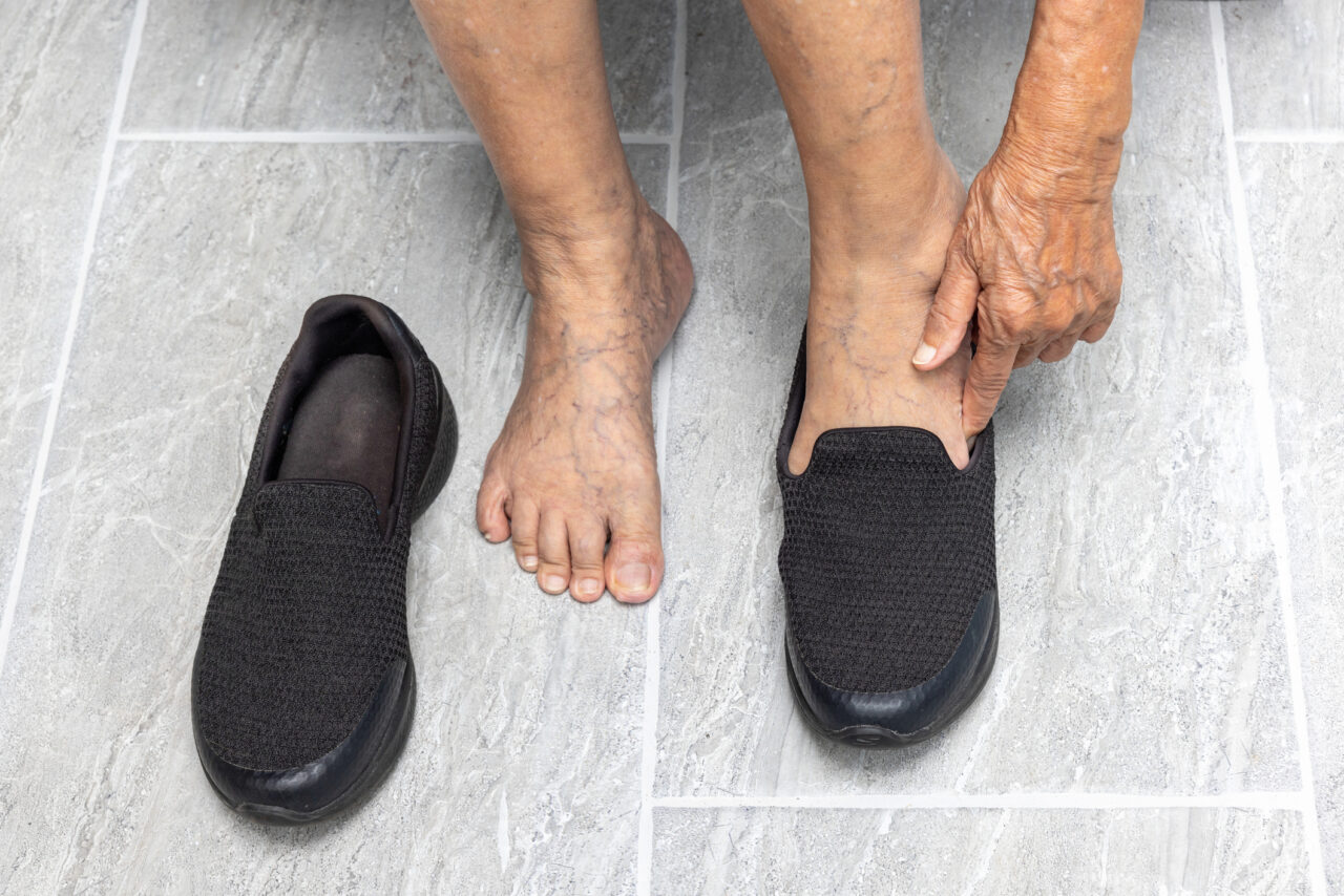Foot Problems in Elderly People - SR Parents